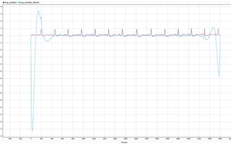 Fft ECG Analysis In MATLAB Signal Processing Stack Exchange