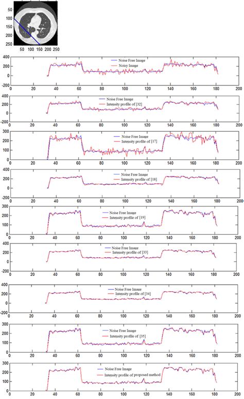 Intensity Profile Of Noise Free And Denoised Ct Image Of Different