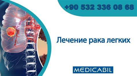 Blog | Лечение рака лёгких