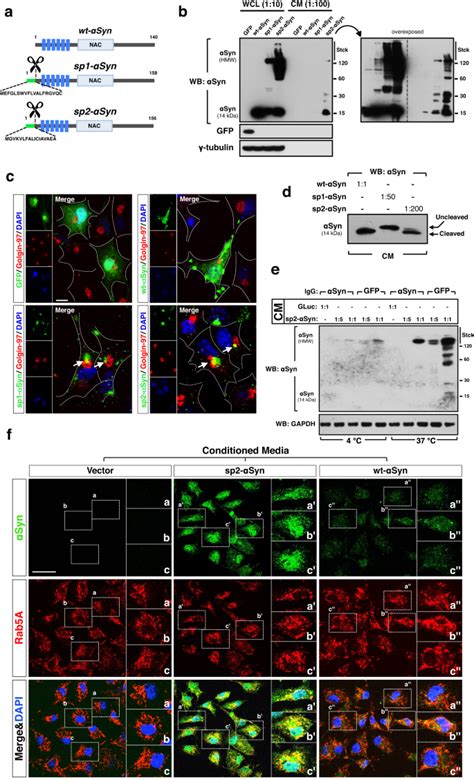 细胞间传播的α 突触核蛋白重现了实验性帕金森病npj Parkinsons Disease X Mol
