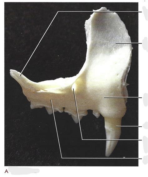 Diagram Of Maxilla Lateral View Quizlet