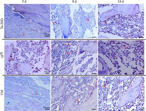 Representative Images Showing Ihc Staining For Cd68 On Days 3 9 And 14 Download Scientific
