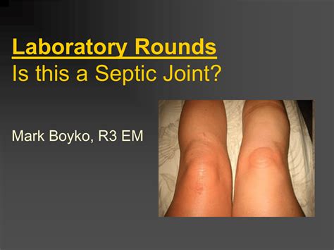 Laboratory Rounds Is This A Septic Joint