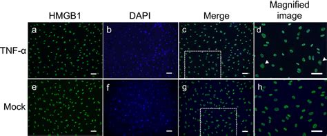 Tnf α Stimulation Induced The Translocation Of Hmgb1 Hmgb1 Was Stained
