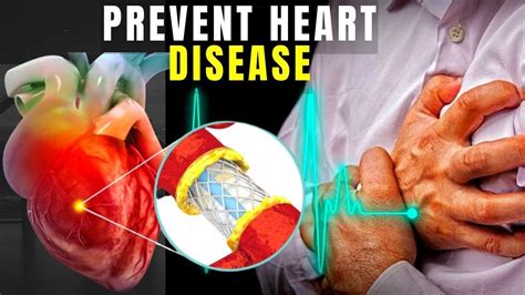 Ways To Prevent Heart Disease Reduce Heart Attack Risk How To Prevent