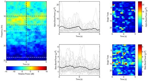 17 Eeg Data Of Subject 14 Visualization Of Mean Spectrogram Mu And