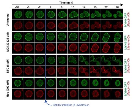 9 Cdk1 Inhibition In The Presence Of Mitotic Spindle Triggers Download Scientific Diagram