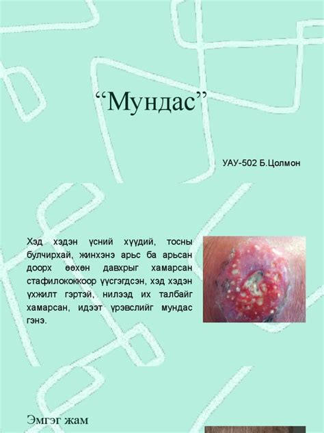 Мундас Pdf
