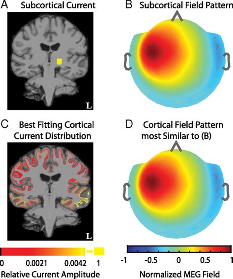 Sparsity Enables Estimation Of Both Subcortical And Cortical Activity From Meg And Eeg Pnas