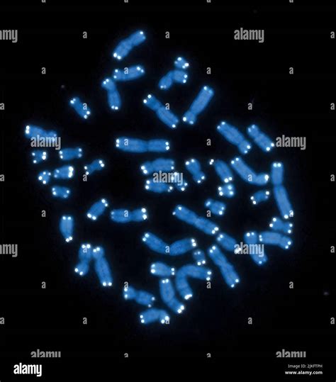 The 46 Human Chromosomes Are Shown In Blue With Telomeres Appearing As
