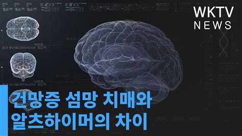 건망증 섬망 치매와 알츠하이머의 차이 Youtube