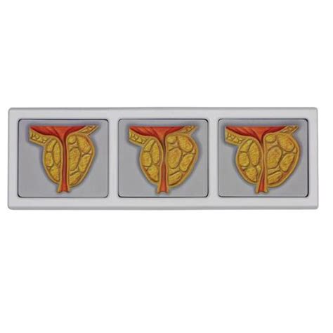 Genital And Pelvis Models — Health Simulation