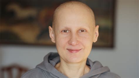 Leucemia Linfoide Aguda Quais Os Desafios Desse Tipo De Leucemia Em