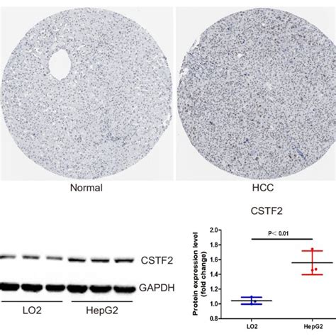 Establishment And Validation Of A Prediction Nomogram In TCGA And ICGC
