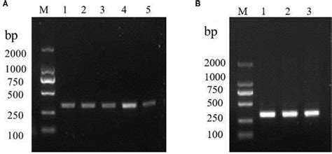 Figure 1 From A Novel Reverse Transcription Recombinase Polymerase Amplification Assay For Rapid