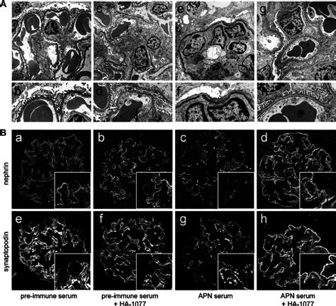 Podocyte Foot Process Morphology And Slit Membrane Protein Distribution Download Scientific