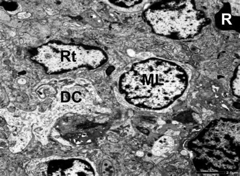 Transmission Electron Micrograph Of The Splenic Marginal Zone Of The