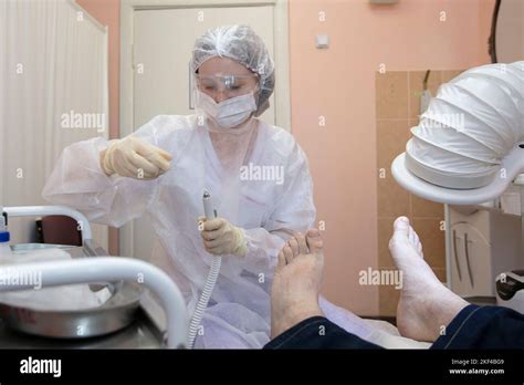 Tratamiento De Hongos En Las U As Del Pie En El Hospital Fotograf A De