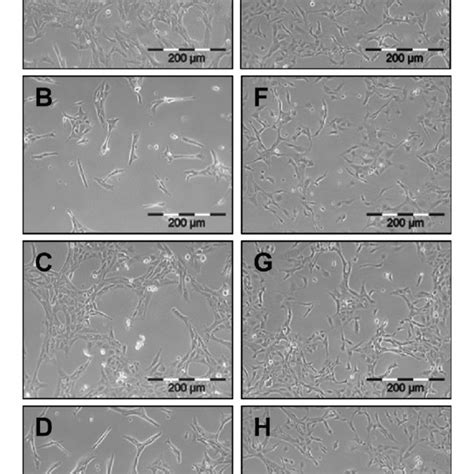 Morphology Of Immortalized Synovial Fibroblasts Treated With