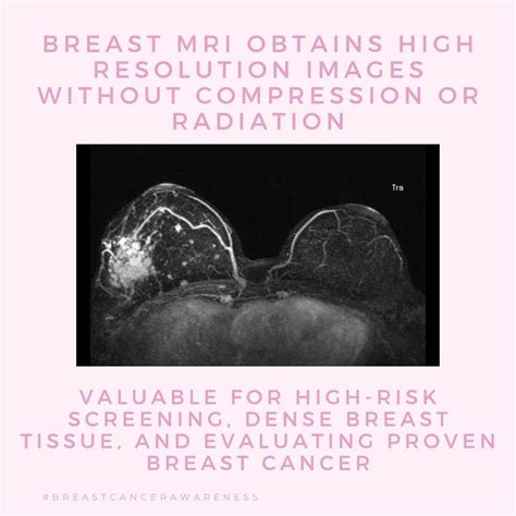 Noosa Radiology Breast Magnetic Resonance Imaging Mri