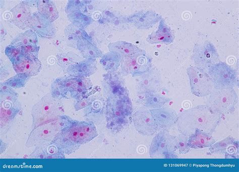 Cheek Epithelial Cells Under Microscope