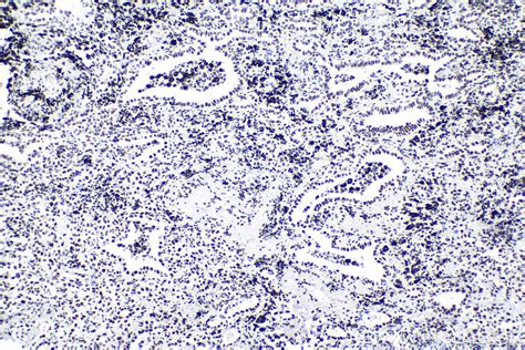 Ihceasy Hist1h3a Ready To Use Ihc Kit Khc1675 Proteintech