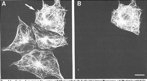 Microtubule Polymerization Process Semantic Scholar
