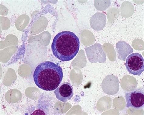 Basophil Erythroblast Horiba
