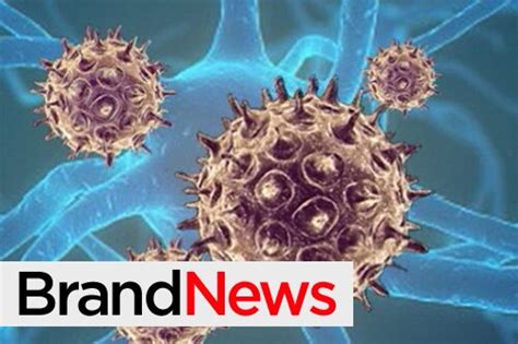 Shingles May Cause Blindness Abs Cbn News