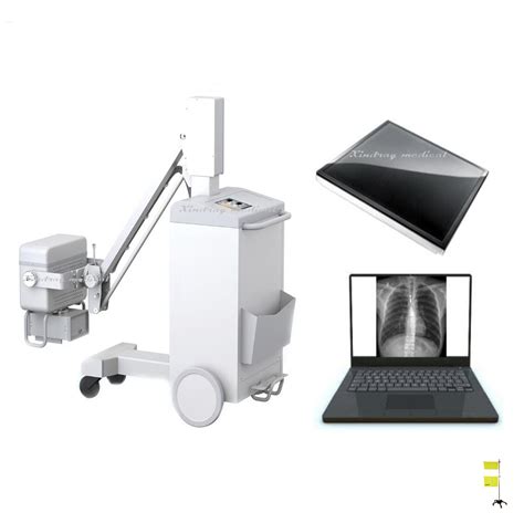 150ma X Ray Machine With High Efficient Fpd System For Digital Imaging Effect China X Ray