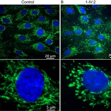 Mitochondria Morphology Analysis Using Mitochondria Network Analysis