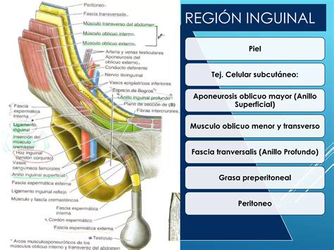 Hernias Inguinales Y Torsion Testicular Ppt