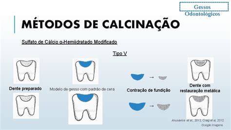 Gessos Odontolgicos Faculdade De Odontologia De Ribeiro Preto