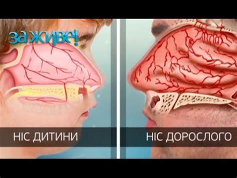 5 ошибок, которые вы допускаете при кровотечении из носа – За живе ...