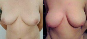 Comparing 36D S On The Left And 36E S On The Right A Noticeable Difference Porn Pic