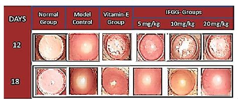 Macroscopic Evaluation Of Progression Of Cataract On 12 Th And 18 Th Download Scientific