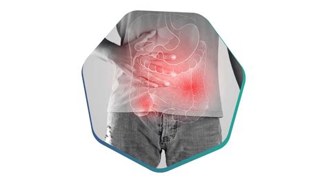 Gastrointestinal Cancer Treatment In Mumbai Ssohospital