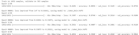 Tensorflow版使用unet进行医学图像分割skin数据集皮肤病理医学图像分割数据集 Csdn博客