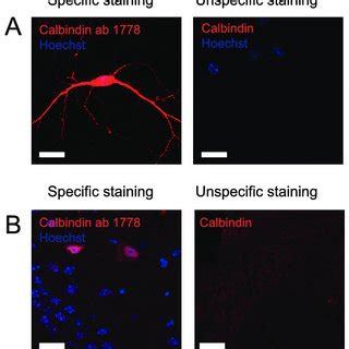 Staining Against Calbindin A Shows Specific And Unspecific Staining Download Scientific