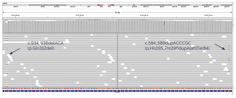 Accurate Detection By Ngs Of Calr Cebpa Flt3 Genes