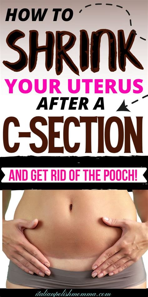A New Mom Showing Her Postpartum C Section Scar And How Great It Healed
