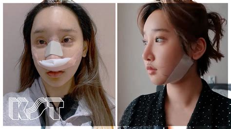 How My Life Has Changed After 30 Times Of Plastic Surgery YouTube