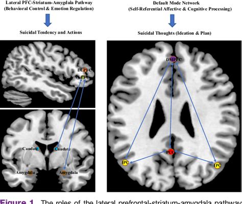 Figure 1 From Multimodal Neural Evidence On The Corticostriatal Underpinning Of Suicidality In