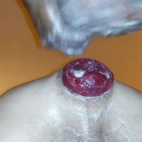 Fuck My Prolapse Free Man Porn Video F7 Xhamster Xhamster