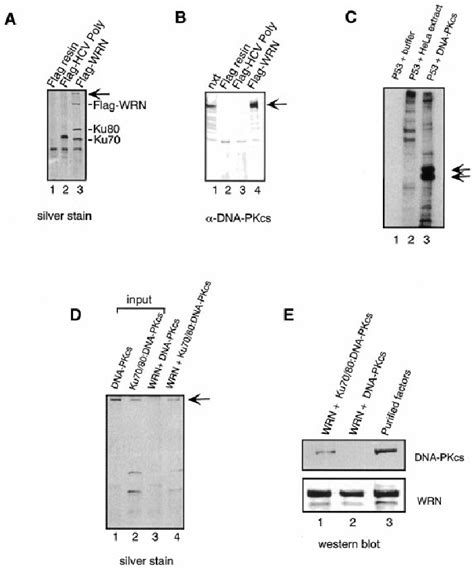 wrn interacts with dna pkcs in the presence of ku a wrn binding