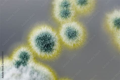 Cheese Mold Under Microscope
