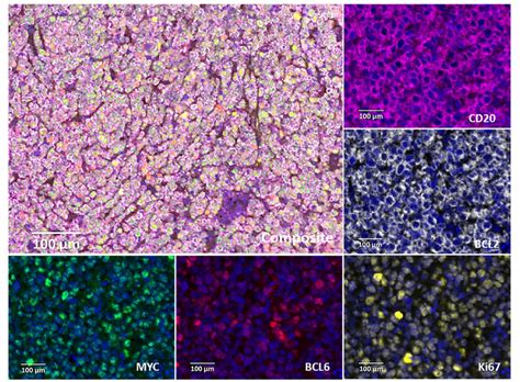 Multiplexed Fluorescent Immunohistochemical Staining Imaging And
