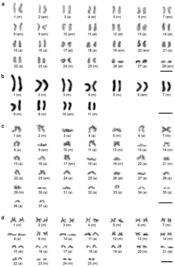Sickle Cell Anemia Karyotype Sickle Cell Anemia Karyotype