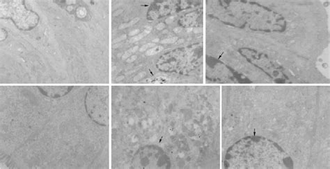Structure Of Apoptotic Enterocytes With Transmission Electron