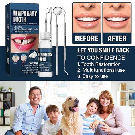 Tooth Repair Kit Temporary Teeth Filling Repair Kit Fixing The